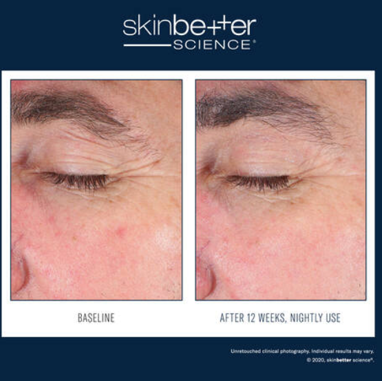 Skinbetter Science EyeMax AlphaRet Overnight Cream 15ml – One Clinic MD