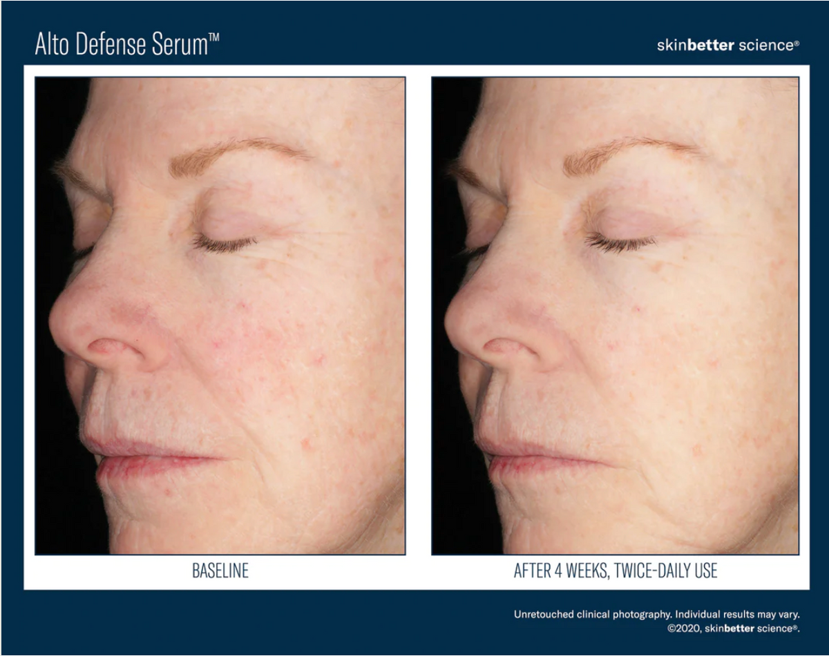 Skinbetter Science Alto Advance Defense and Repair Serum™ 30ml – One ...